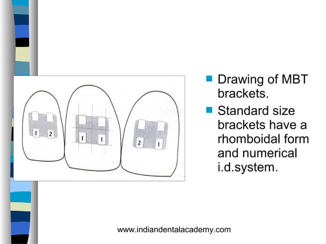 MBT system in orthodontics /certified fixed orthodontic courses by ...