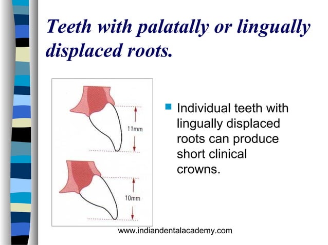 MBT system in orthodontics /certified fixed orthodontic courses by ...