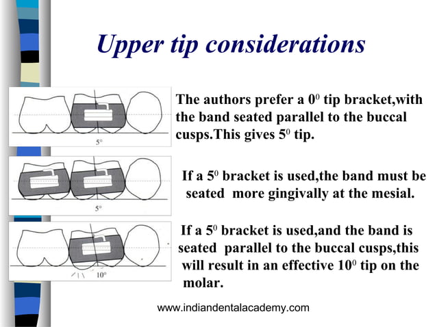 MBT system in orthodontics /certified fixed orthodontic courses by ...