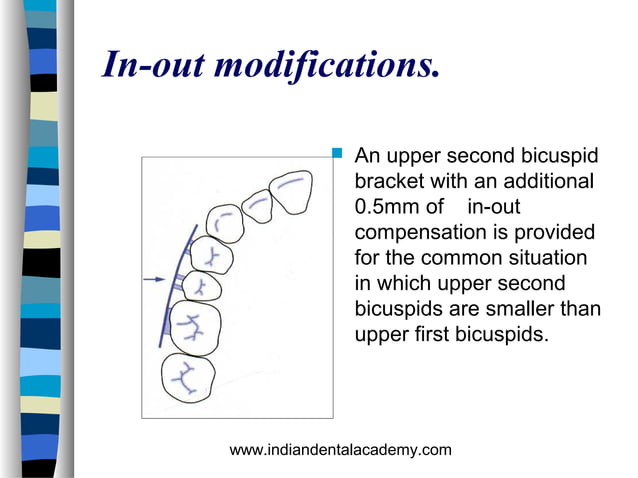 MBT system in orthodontics /certified fixed orthodontic courses by ...