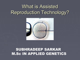 Assisted Reproduction Technology and its Technique | PPT