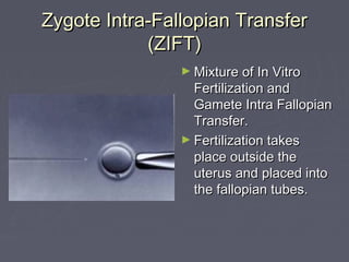 Assisted Reproduction Technology and its Technique | PPT