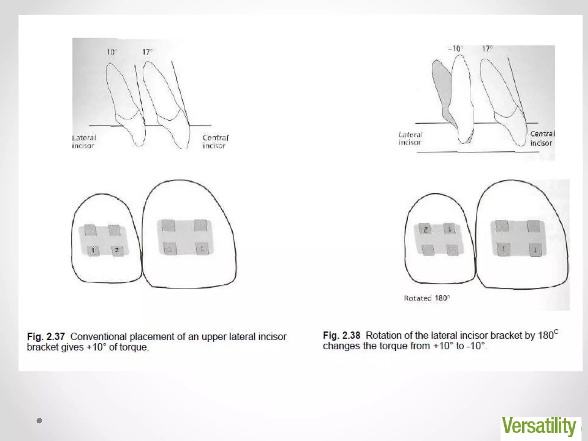 Mbt technique part | PPTX | Dental Health | Diseases and Conditions