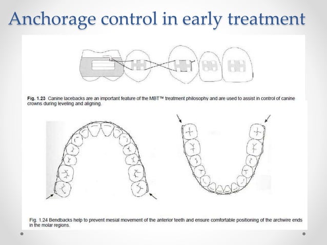 Mbt technique part | PPTX | Dental Health | Diseases and Conditions