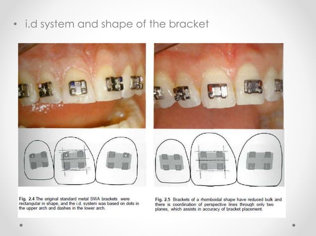Mbt technique part | PPTX | Dental Health | Diseases and Conditions
