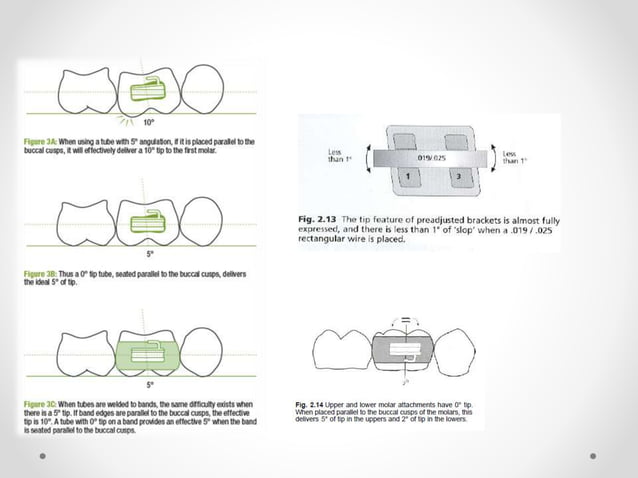 Mbt technique part | PPTX | Dental Health | Diseases and Conditions