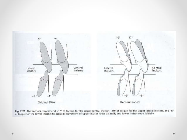Mbt technique part | PPTX | Dental Health | Diseases and Conditions