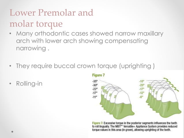 Mbt technique part | PPTX | Dental Health | Diseases and Conditions
