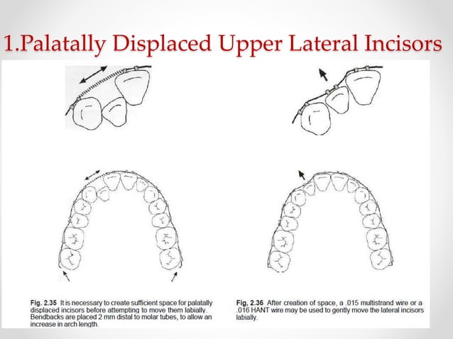 Mbt technique part | PPTX | Dental Health | Diseases and Conditions