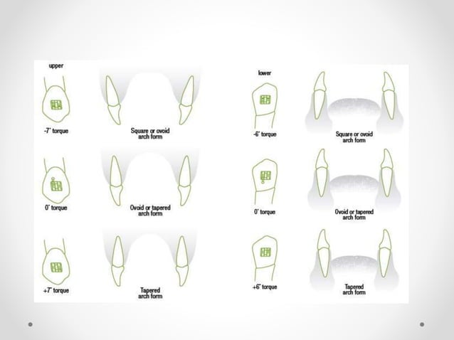 Mbt technique part | PPTX | Dental Health | Diseases and Conditions
