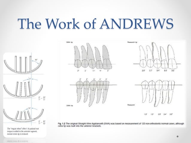 Mbt technique part | PPTX | Dental Health | Diseases and Conditions