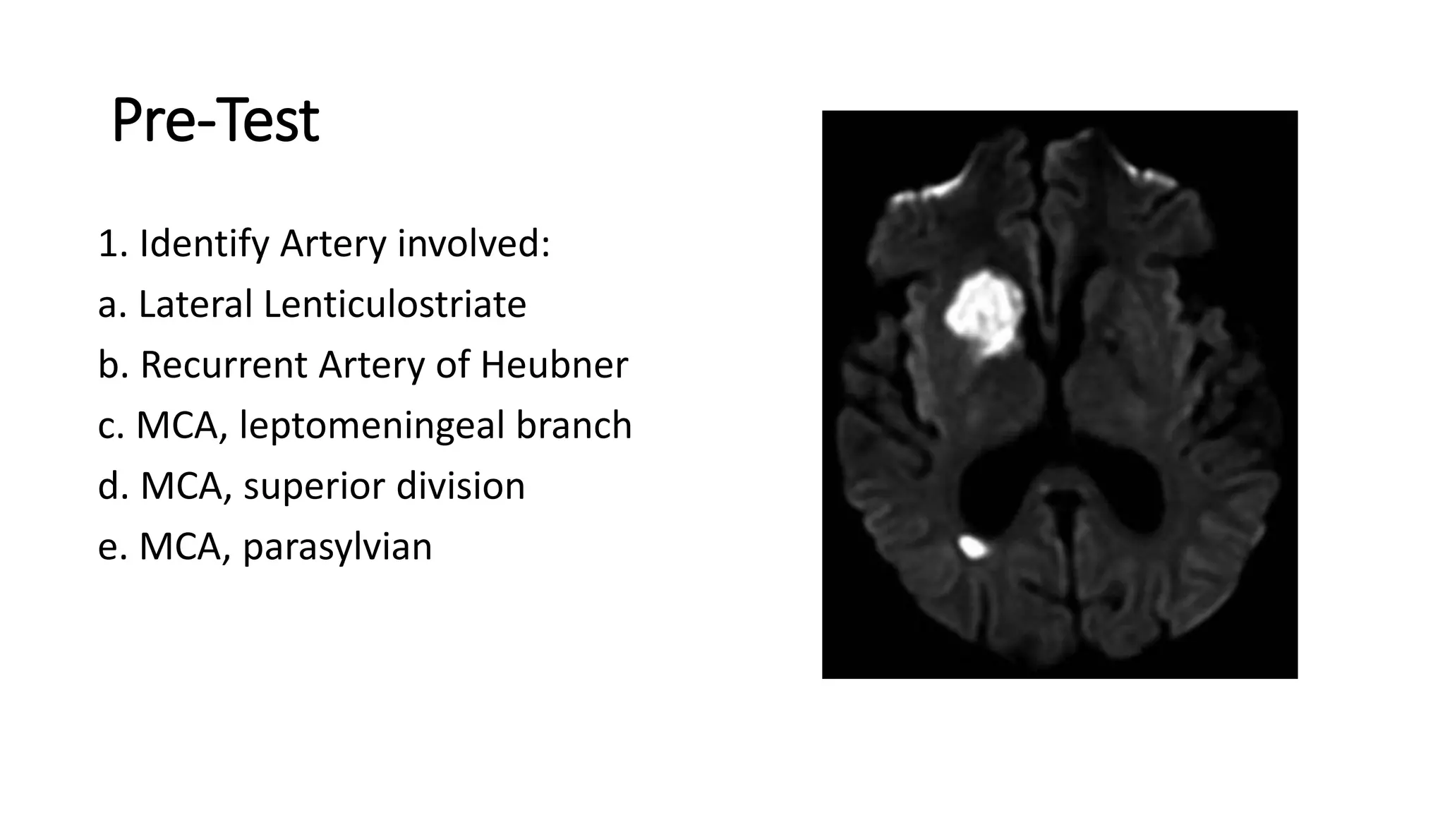 Mca & aca syndromes | PPTX