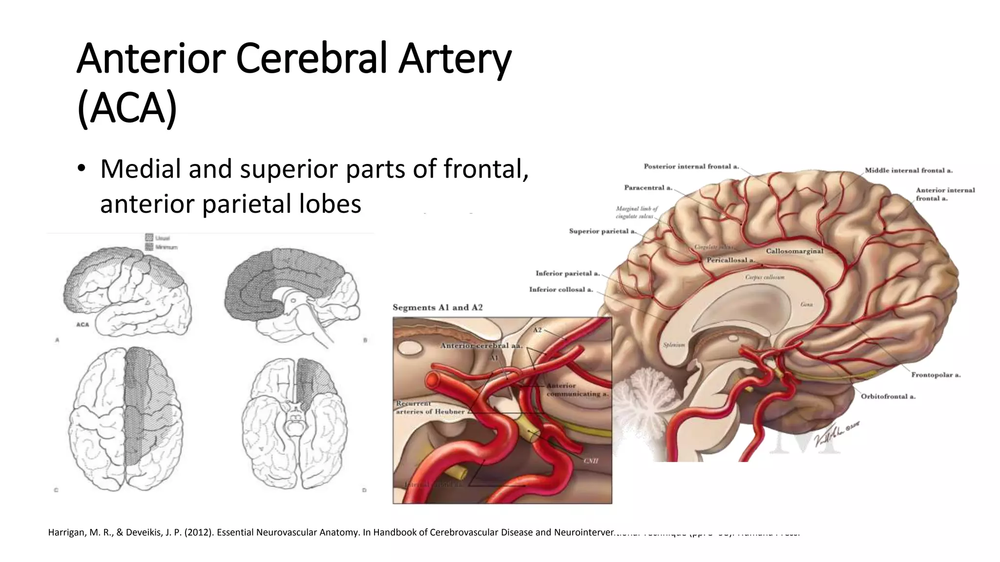 Mca & aca syndromes | PPTX