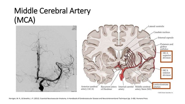 Mca & aca syndromes | PPTX