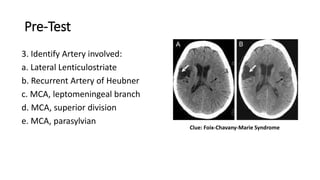 Mca & aca syndromes | PPTX