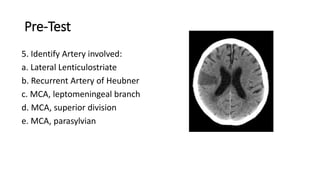 Mca & aca syndromes | PPTX