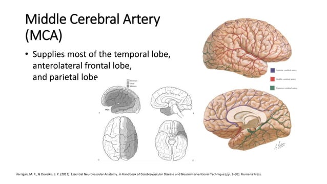 Mca & aca syndromes | PPTX
