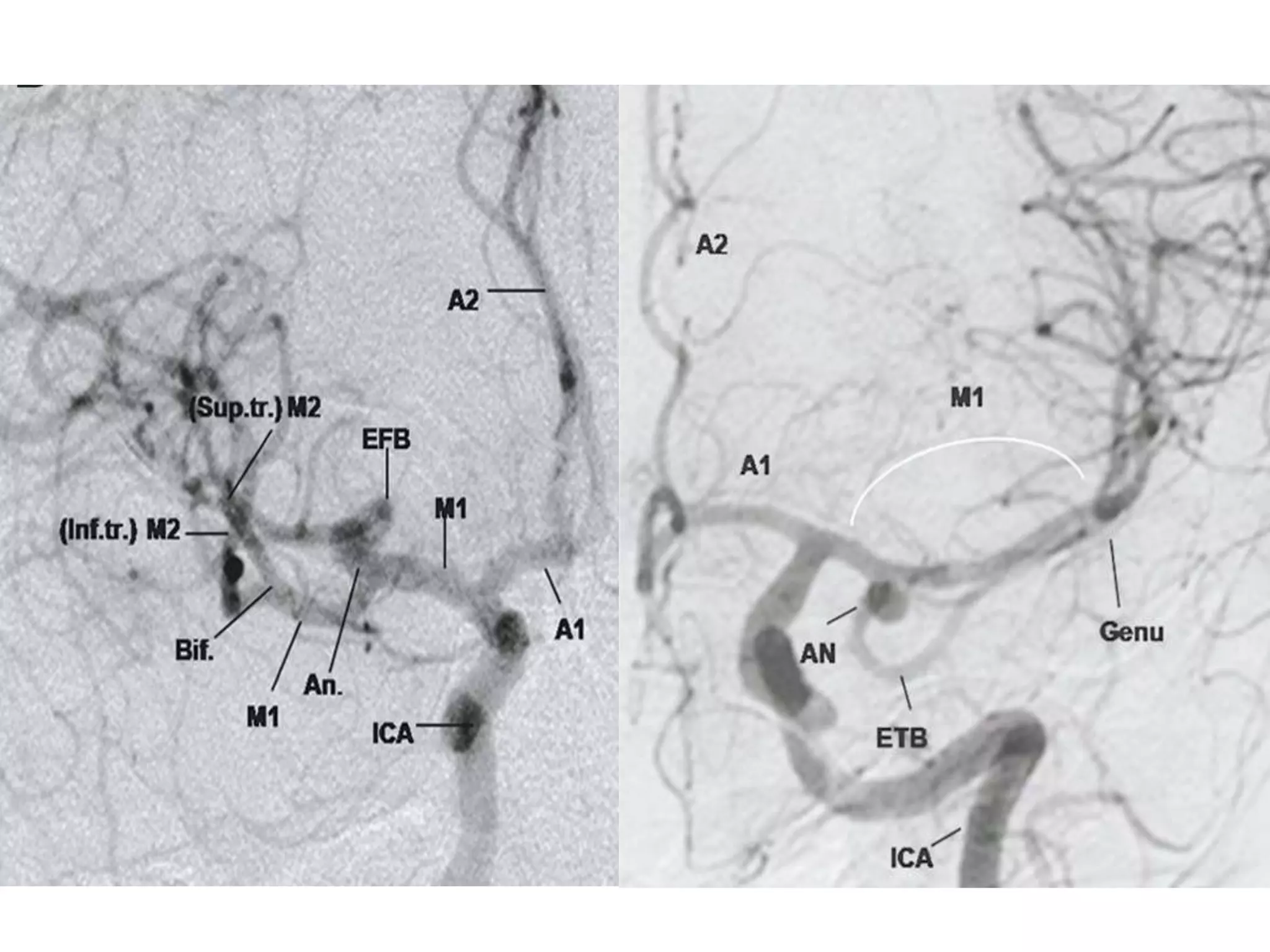middle cerebral artery anatomy | PPTX