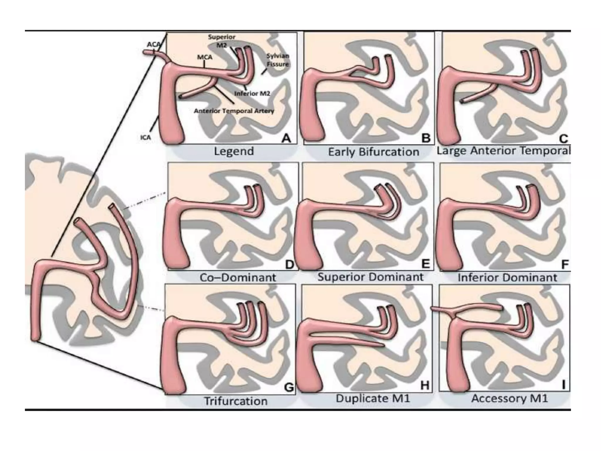 middle cerebral artery anatomy | PPTX