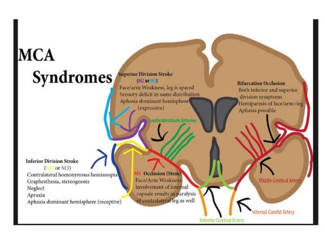 middle cerebral artery anatomy | PPTX | Death, Injury, or Military ...