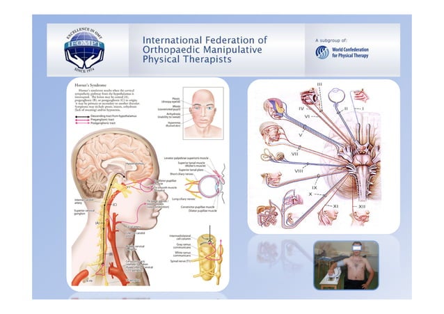Safety of Neck Manipulation | PDF