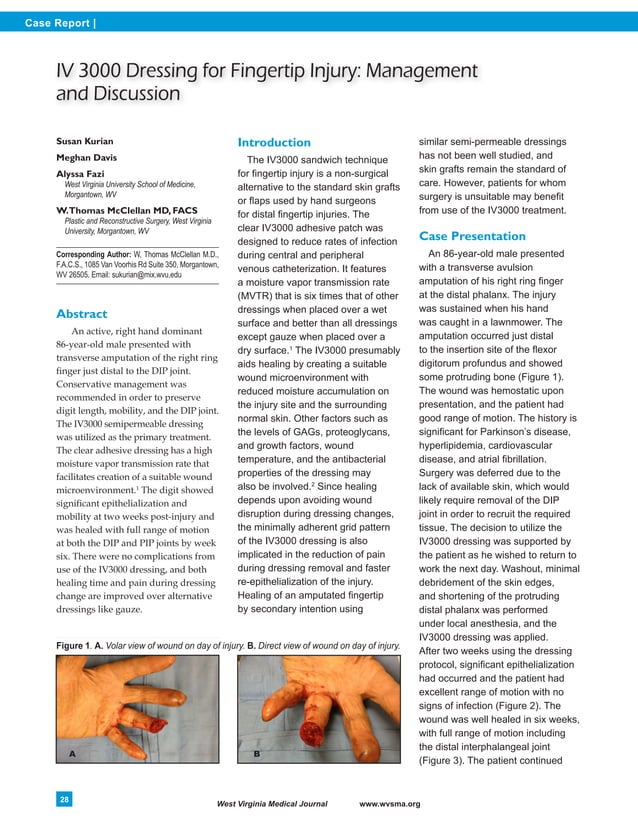 IV3000 Dressing for Fingertip Injuries | PDF
