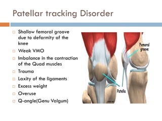 McConnell-Taping-PPT.pdf