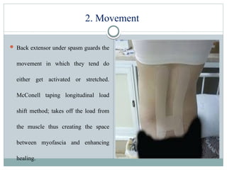 Mcconnell taping technique | PDF