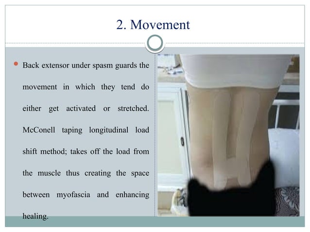 Mcconnell taping technique | PDF
