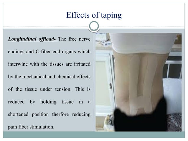 Mcconnell taping technique | PDF