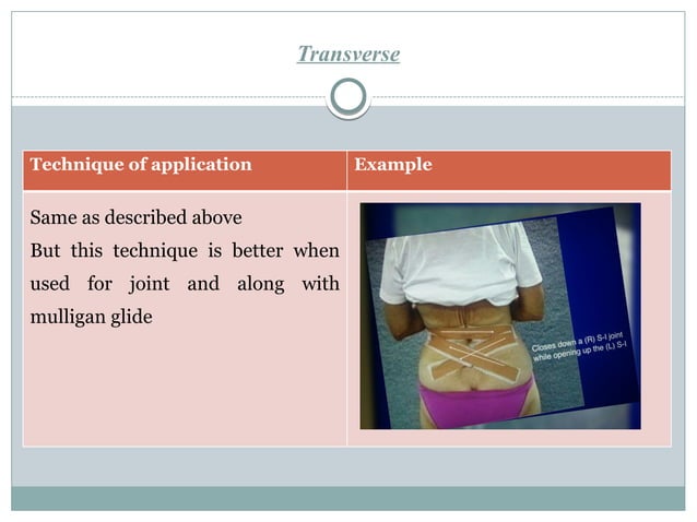Mcconnell taping technique | PDF
