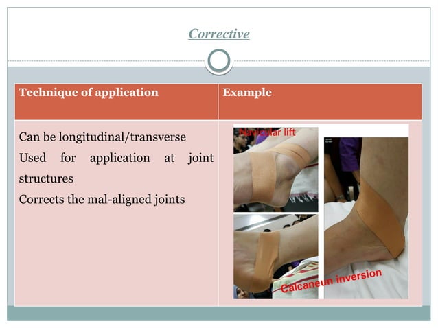 Mcconnell taping technique | PDF