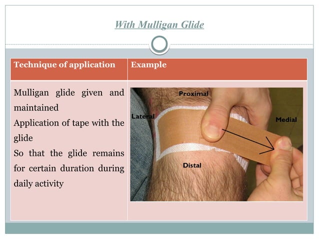 Mcconnell taping technique | PDF