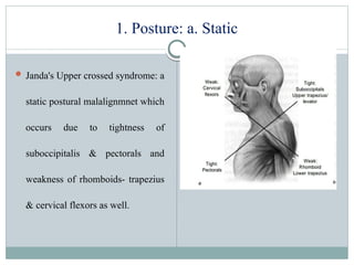 Mcconnell taping technique | PDF