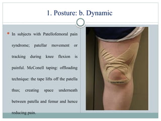Patellofemoral Pain Syndrome Taping