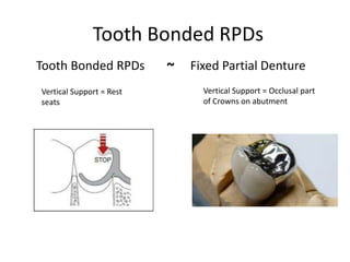 Mc Cracken chapter 2: Consideration for managing Partial tooth Loss | PPTX