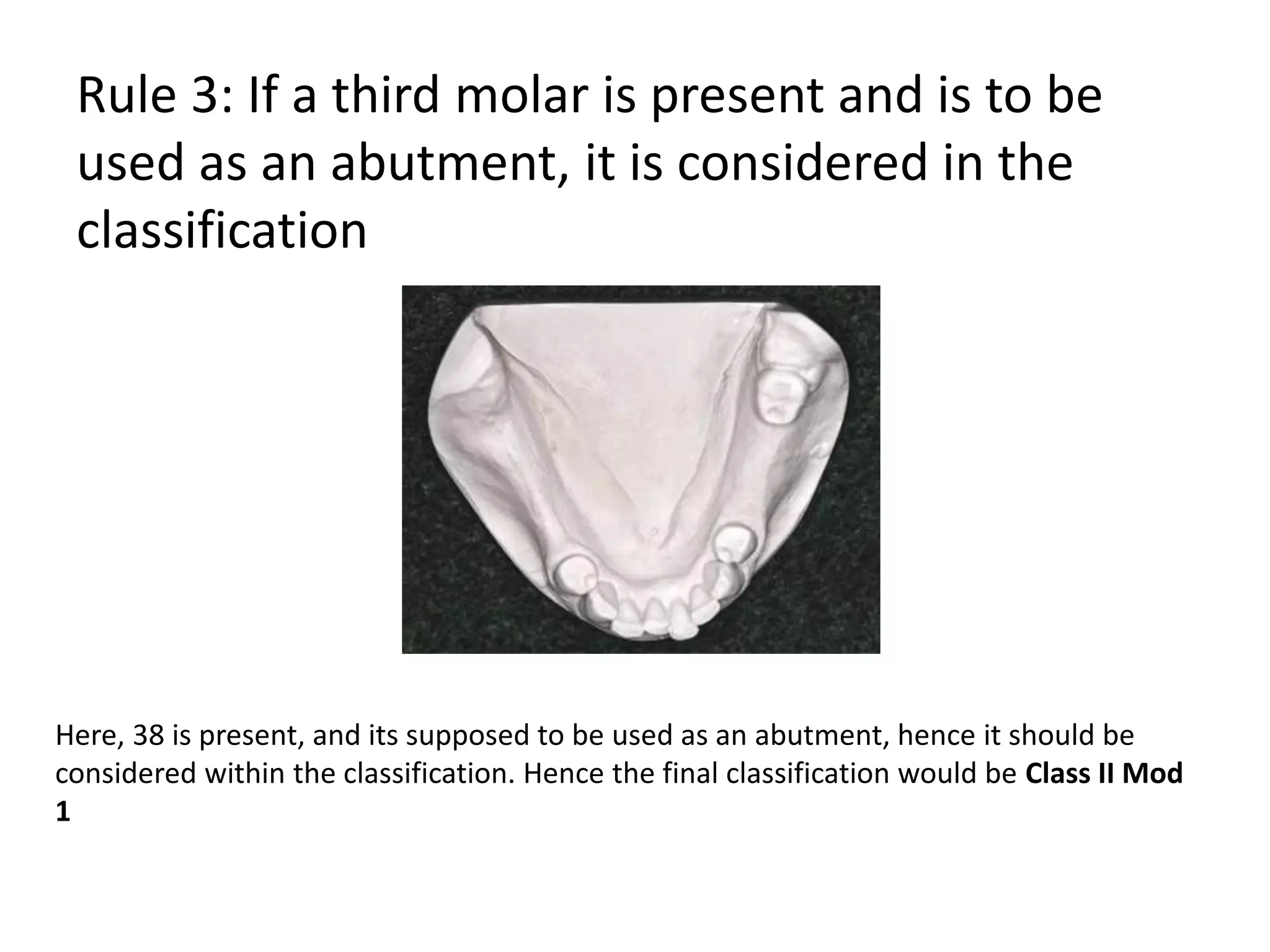 Mc Cracken chapter 3: Classification of Partially Edentulous Arches | PPTX