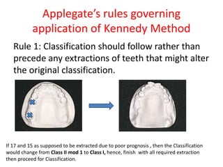 Mc Cracken chapter 3: Classification of Partially Edentulous Arches | PPTX