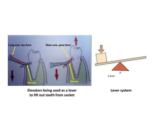 Mc Cracken chapter 4: Biomechanics of Removable Partial Denture. | PPTX