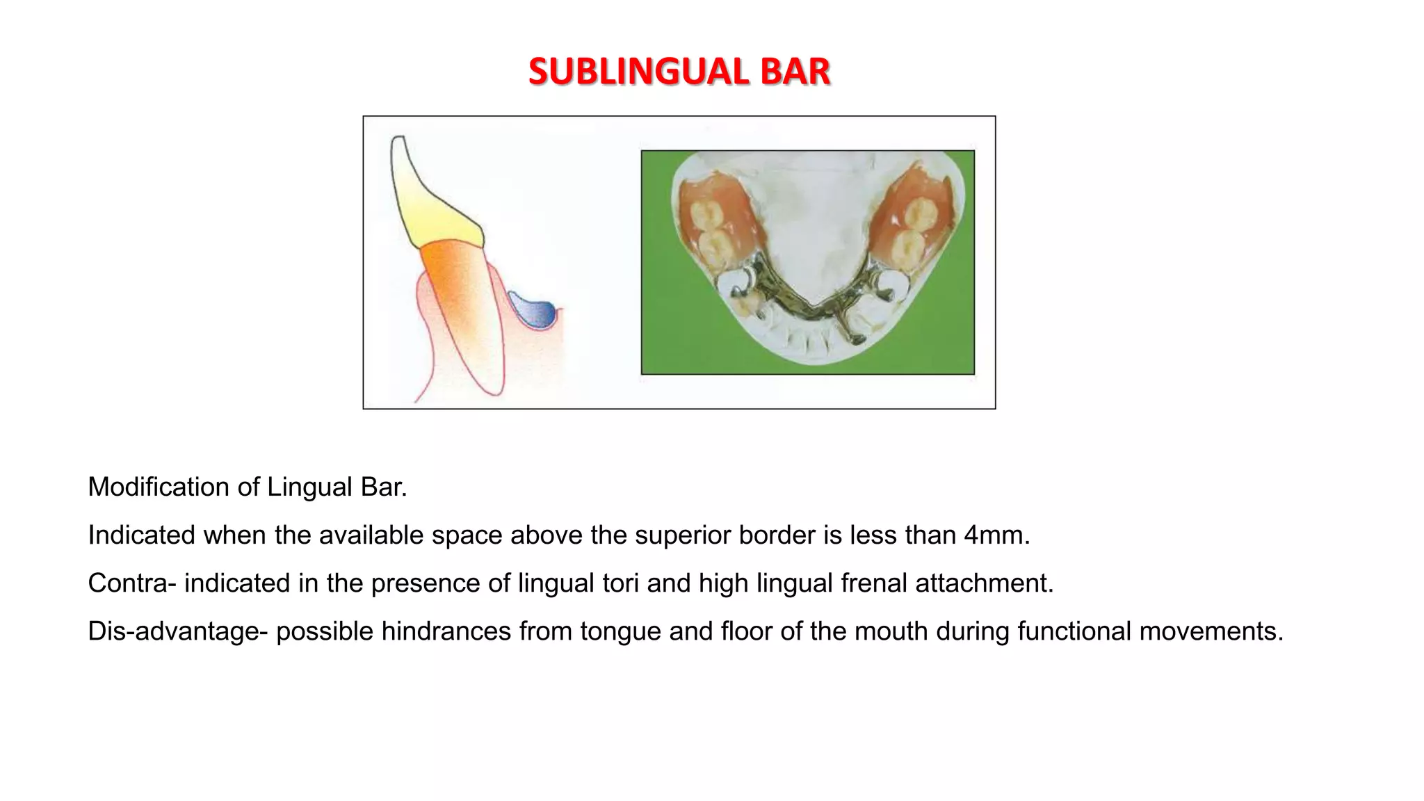 Major and Minor Connectors | PPTX