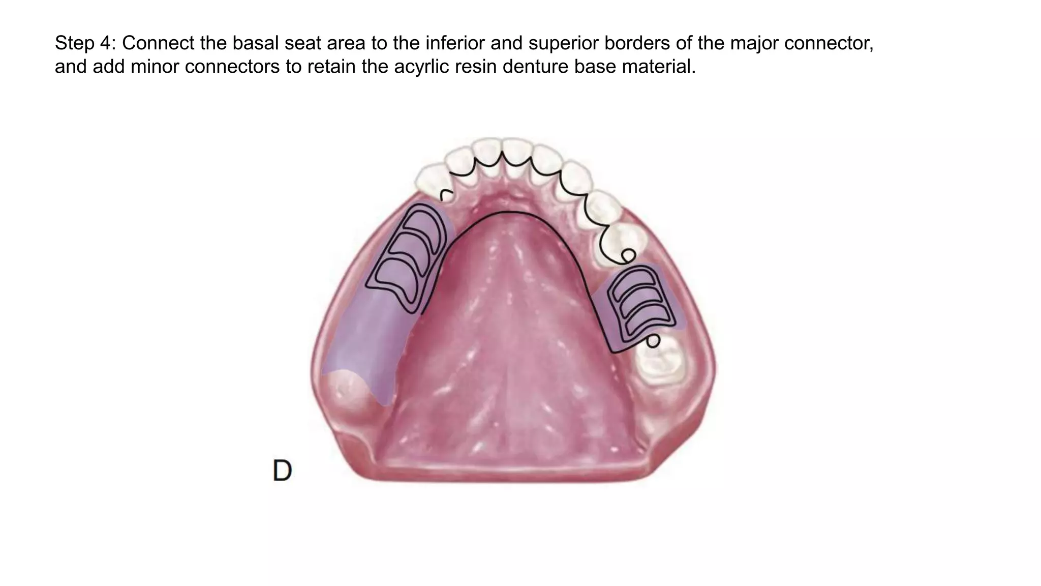 Major and Minor Connectors | PPTX