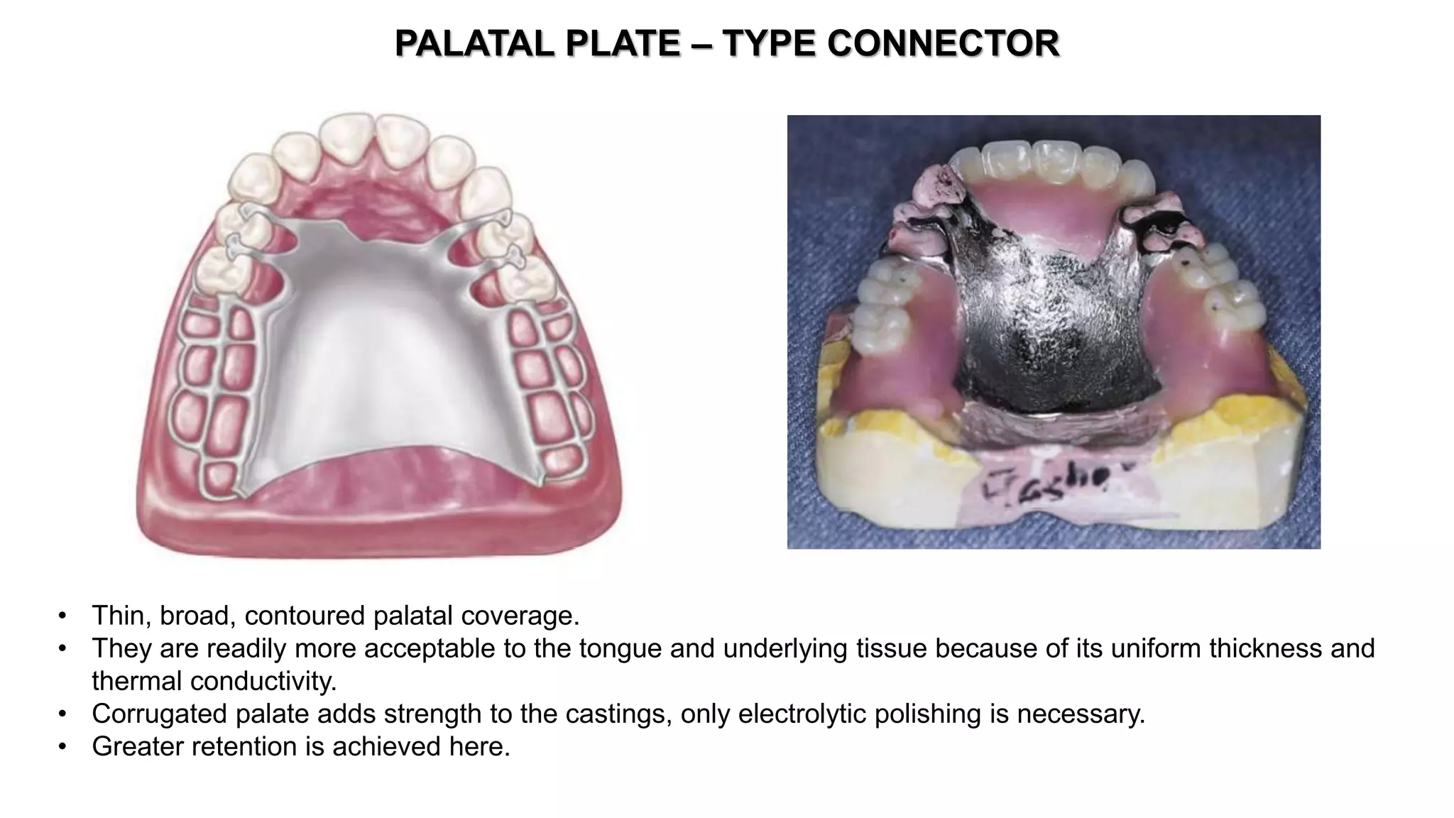 Major and Minor Connectors | PPTX