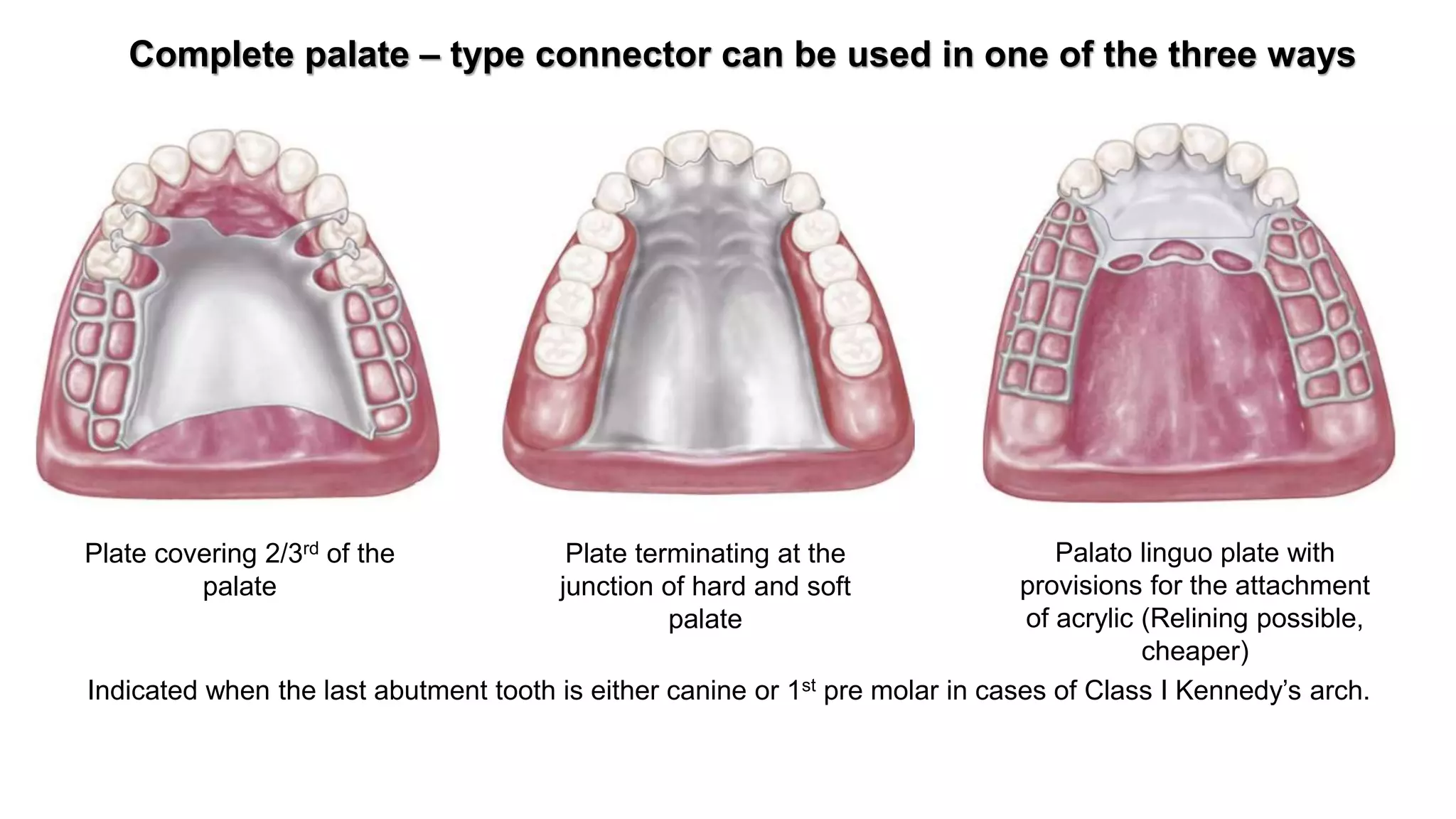 Major and Minor Connectors | PPTX