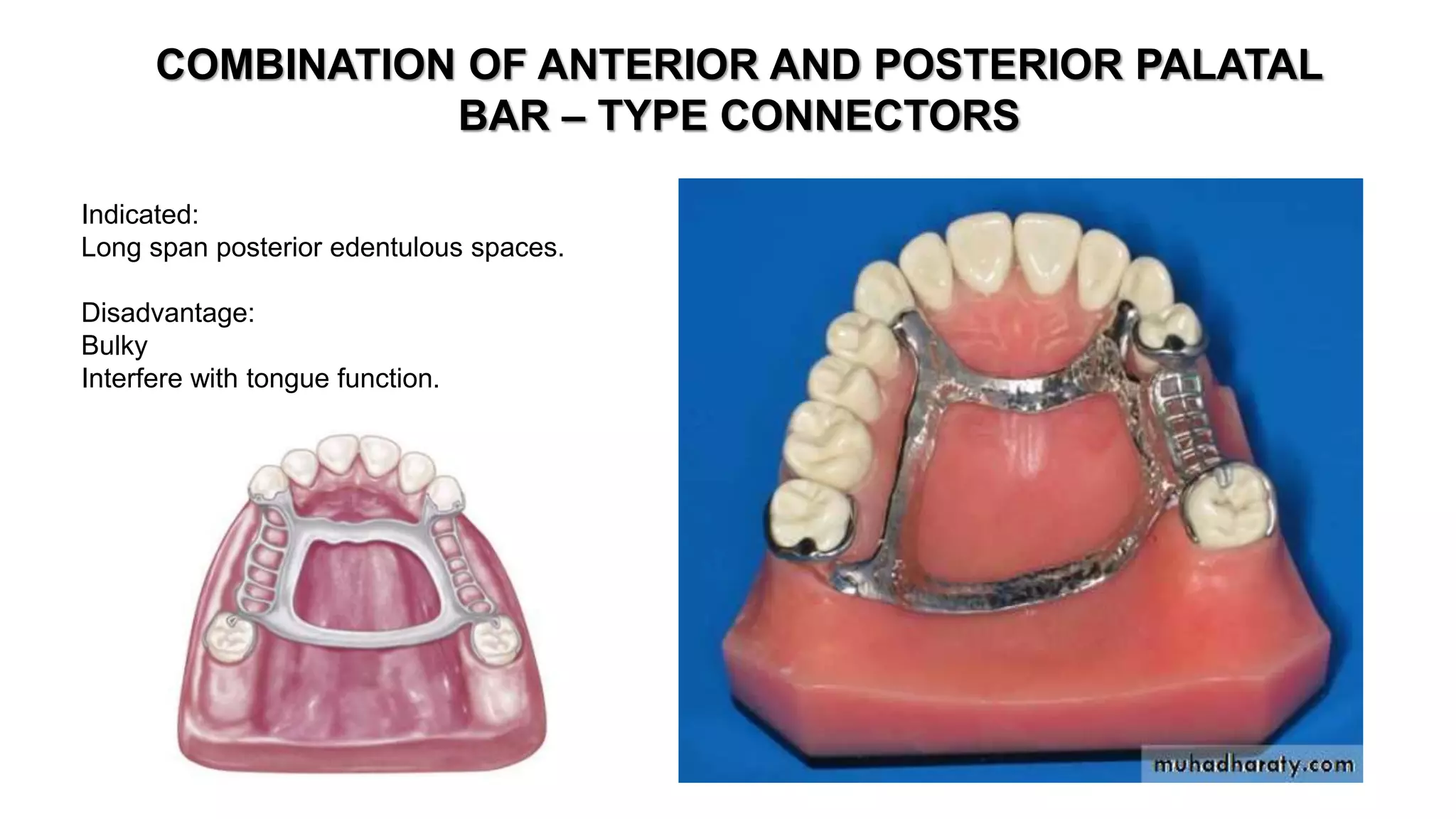 Major and Minor Connectors | PPTX