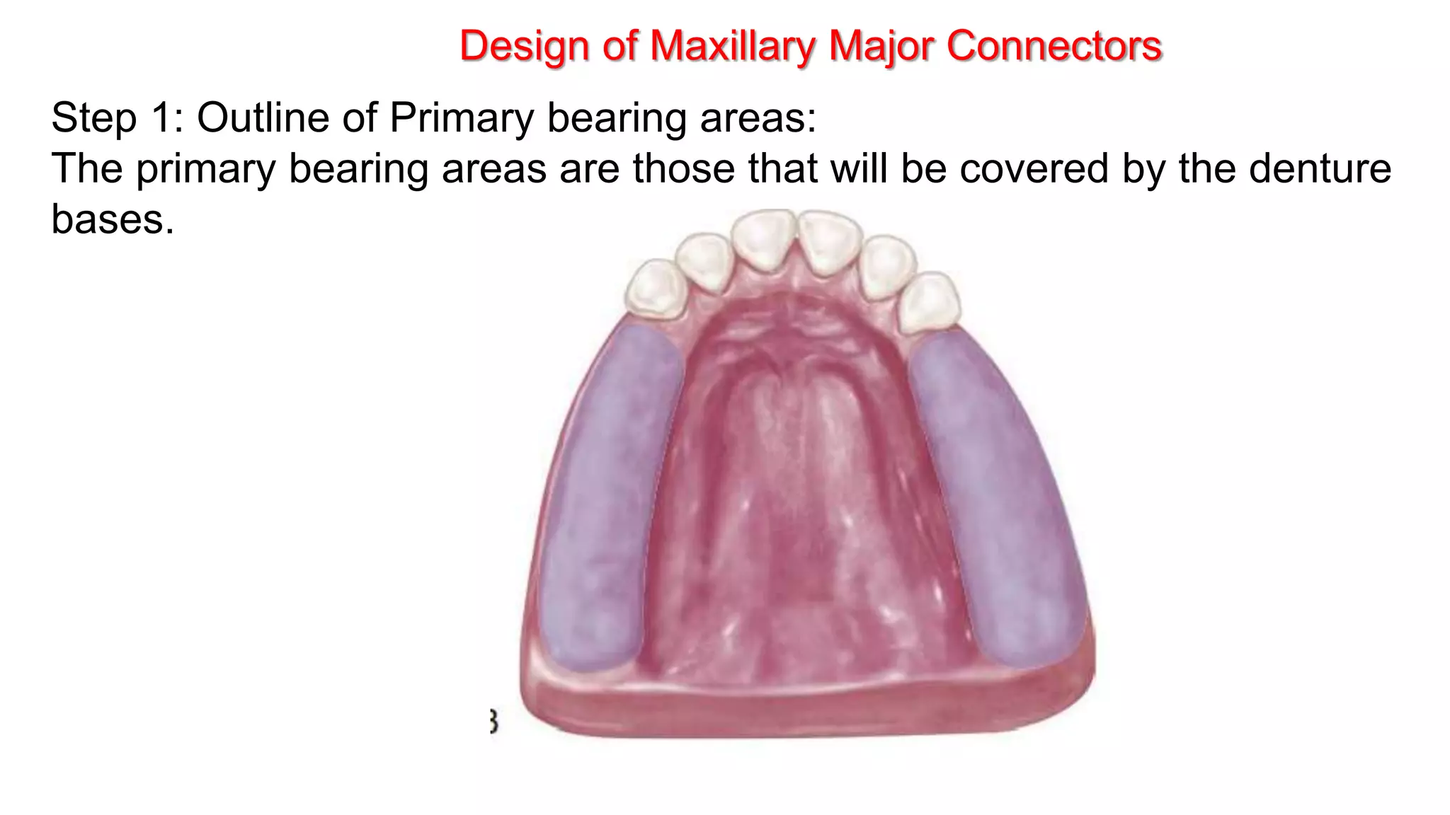 Major and Minor Connectors | PPTX