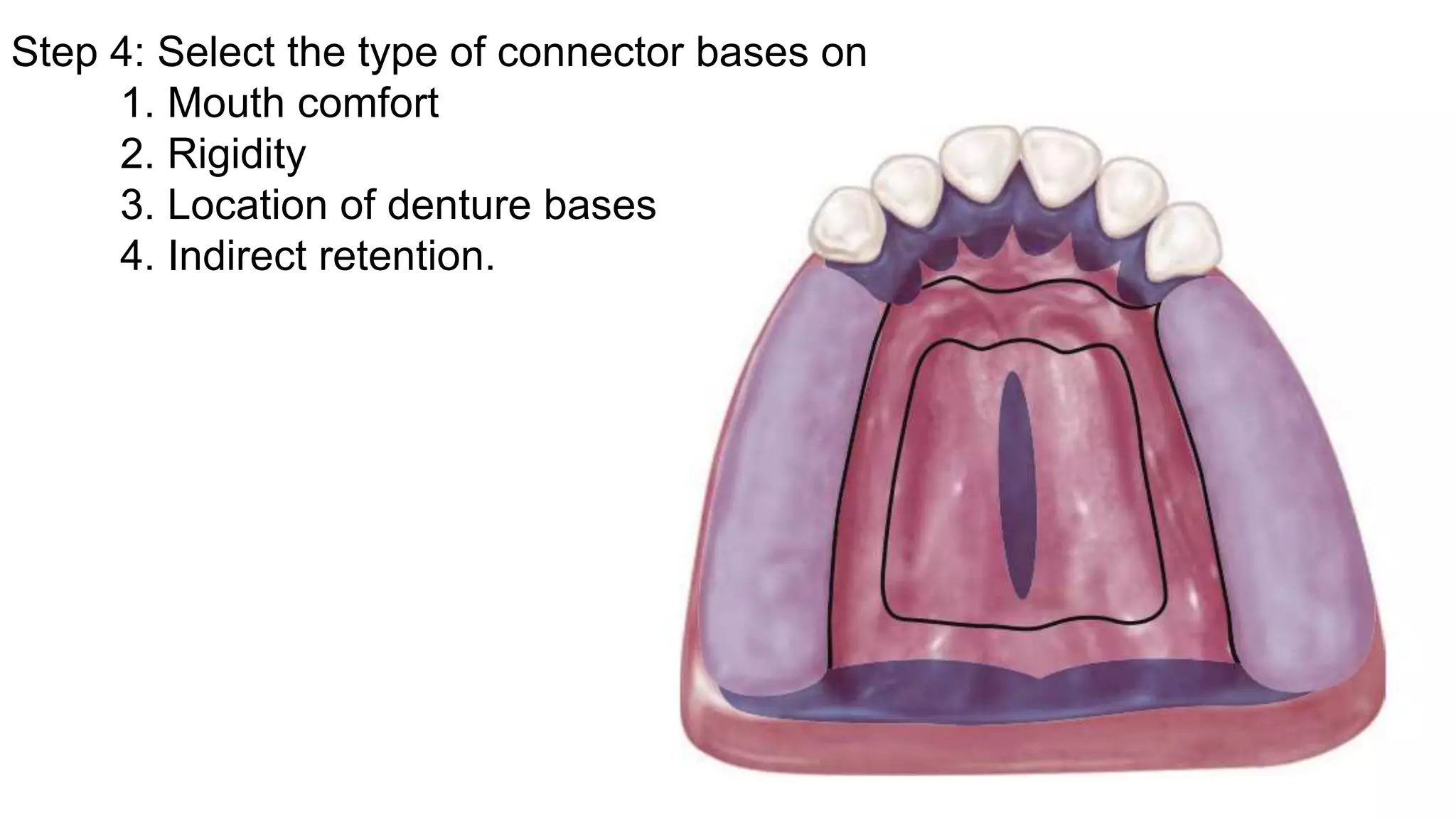 Major and Minor Connectors | PPTX