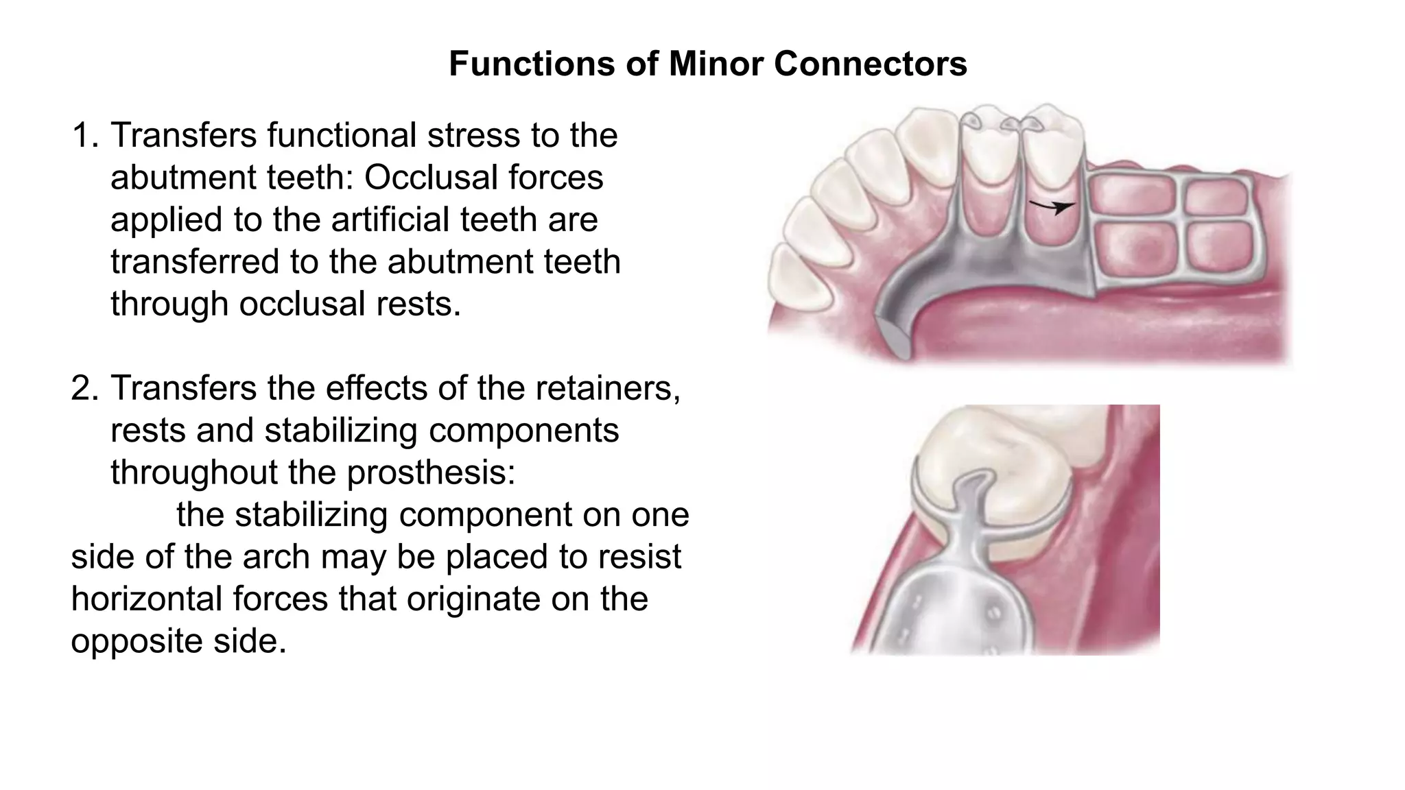 Major and Minor Connectors | PPTX