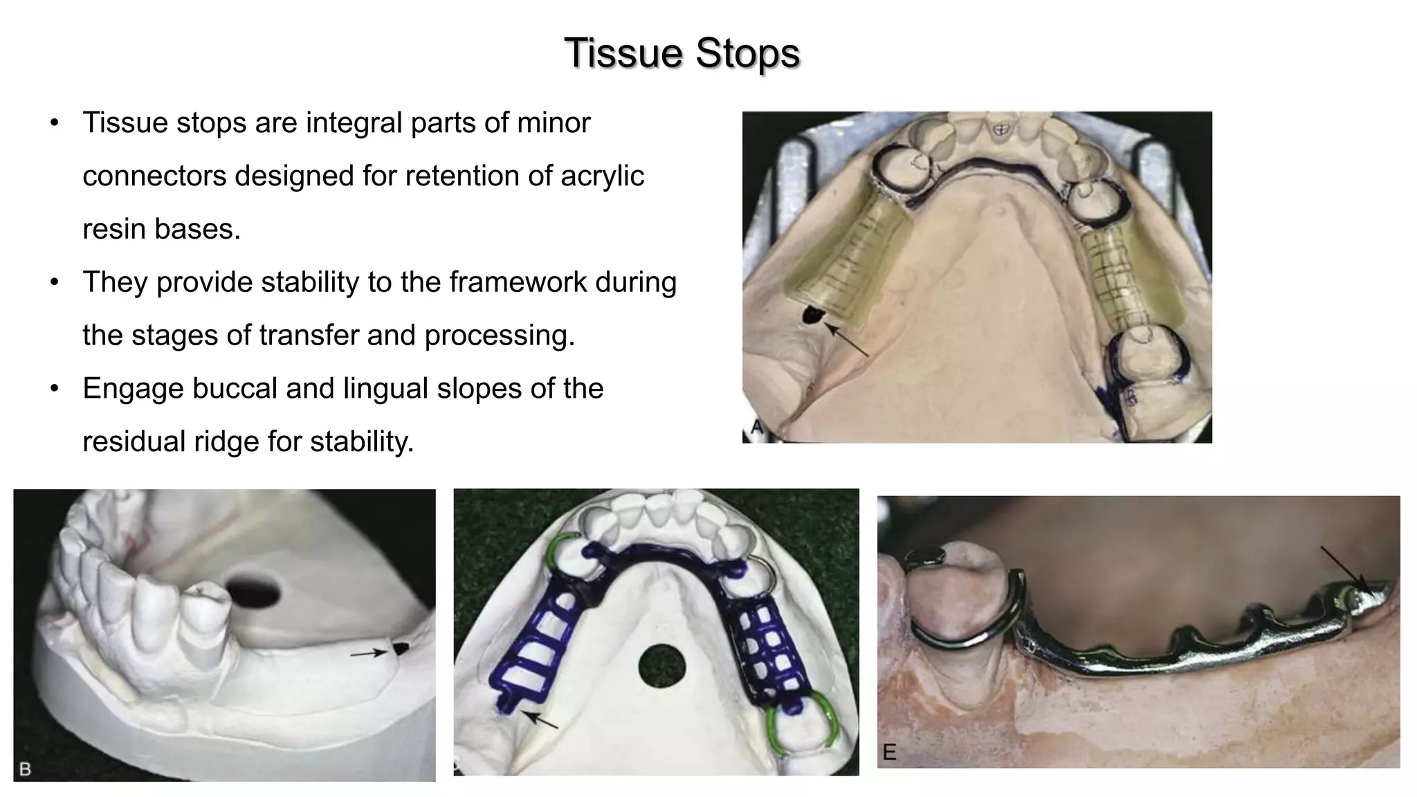 Major and Minor Connectors | PPTX