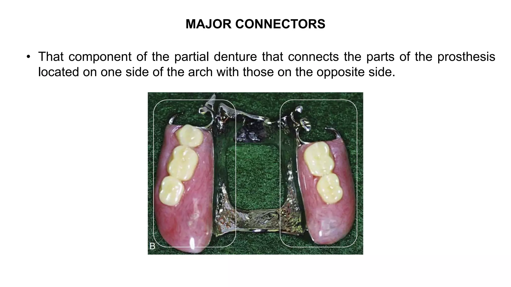Major and Minor Connectors | PPTX