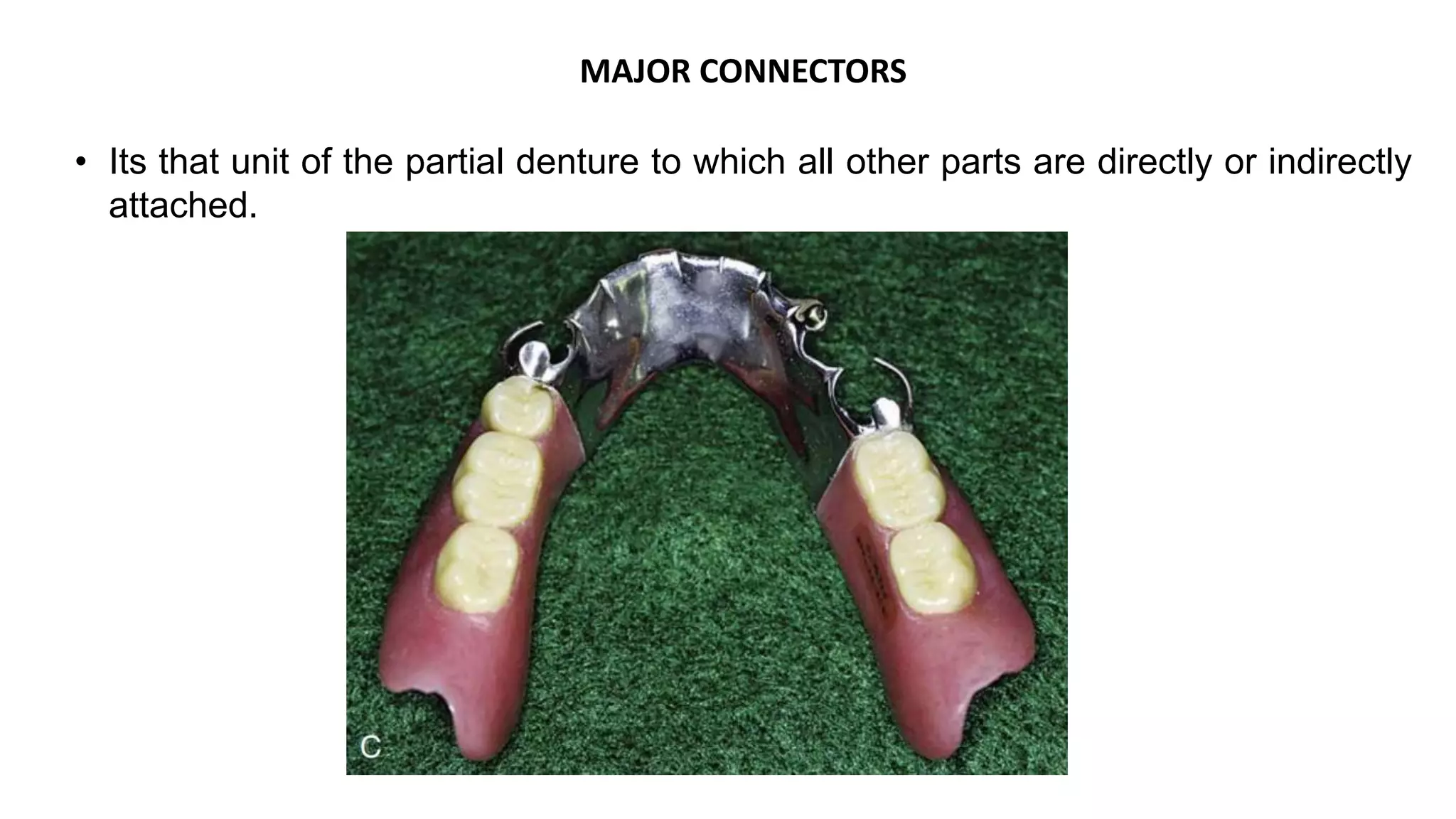 Major and Minor Connectors | PPTX